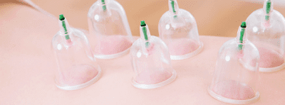 Myofascial Release Trigger Point Therapy in NYC - Massage in NYDNR