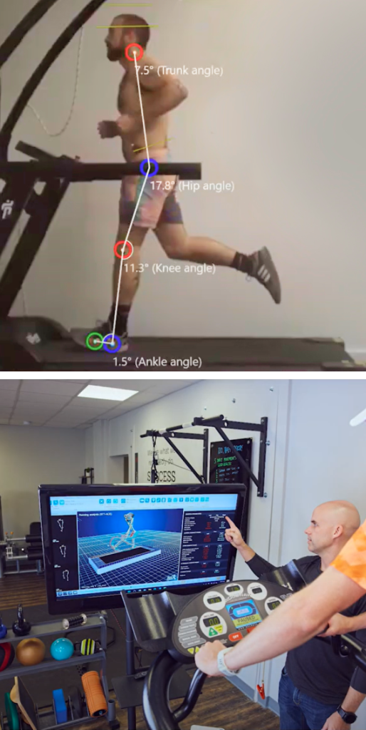 Gait Analysis NYC - Gait Laboratory NYDNRehab
