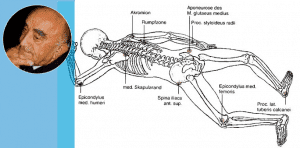 Vaclav Vojta and Reflex Locomotion Therapy