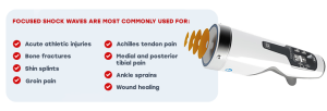 Shockwave Therapy Types, Uses and Benefits - NYDNRehab.com