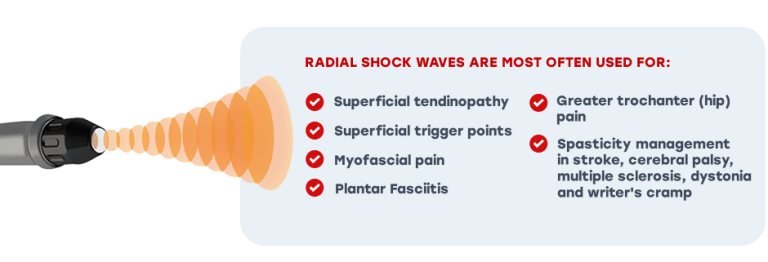 Shockwave Therapy Types, Uses and Benefits - NYDNRehab.com