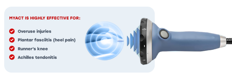 Shockwave Therapy Types, Uses and Benefits - NYDNRehab.com