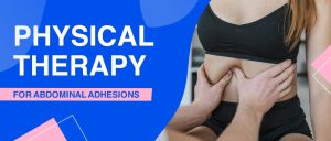 Physical Therapy for Abdominal Adhesions - NYDNRehab.com