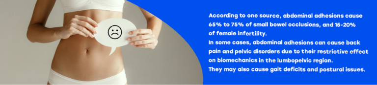 Physical Therapy for Abdominal Adhesions - NYDNRehab.com